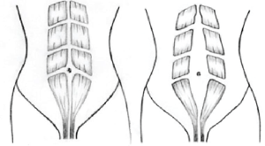 Diastasis Recti: An Overview – Boot Camp & Military Fitness Institute